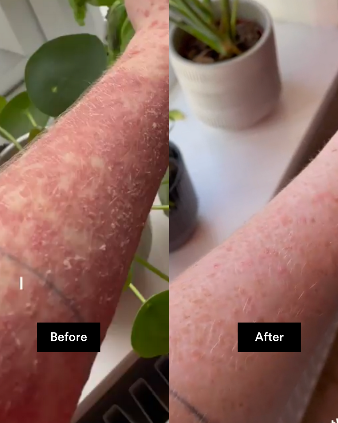 Hello Klean | Showercare Essentials For Hard Water.